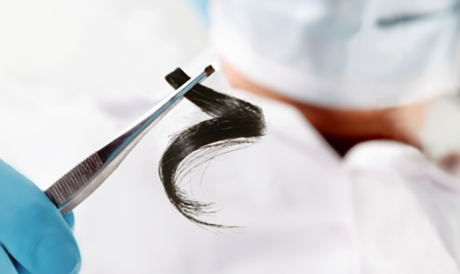 Welcome to the way-back machine called hair testing | Quest Diagnostics